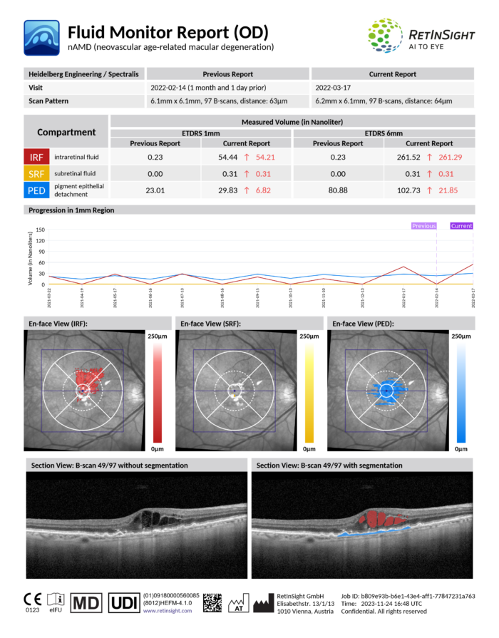 RetInSight Fluid Monitor: Now available with new progression feature ...